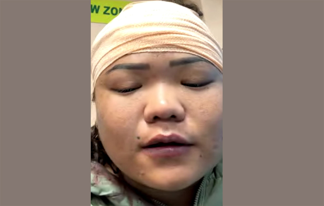 शर्मीला वाइवामाथि बौद्धमा रड प्रहार, टाउकोमा गम्भीर चोट | Nepal Views: Voices, Perspectives ...